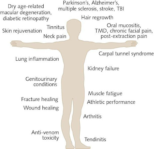 Photobiomodulation Therapy: Light-Tissue Interaction and Its Current State