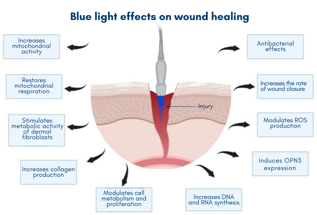 Light Therapy for Wound Healing: An Emerging Solution