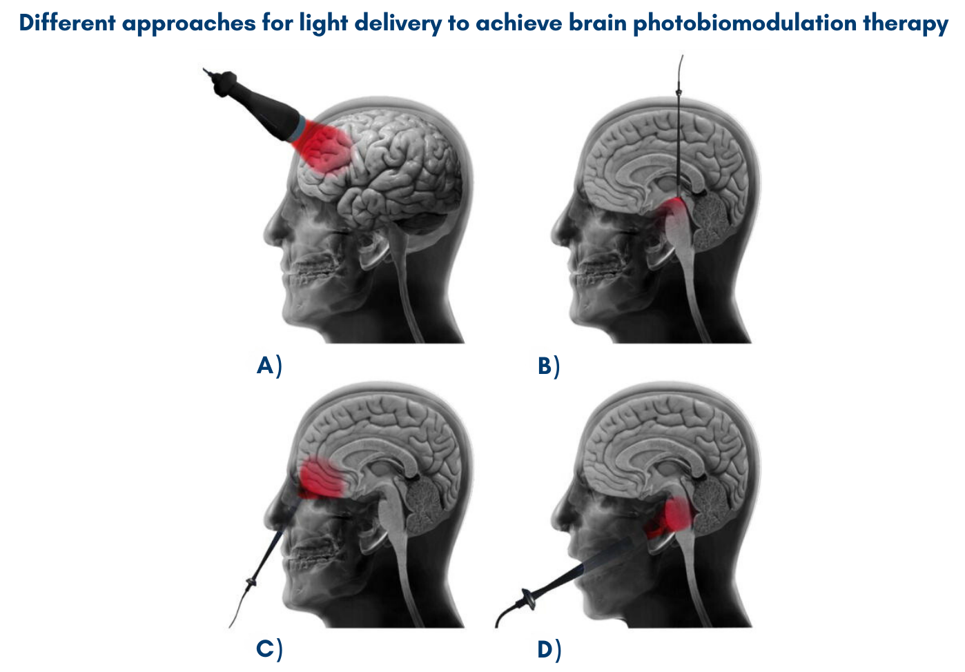 Innovative, Non-Invasive PBM Therapy for Neurological Healing