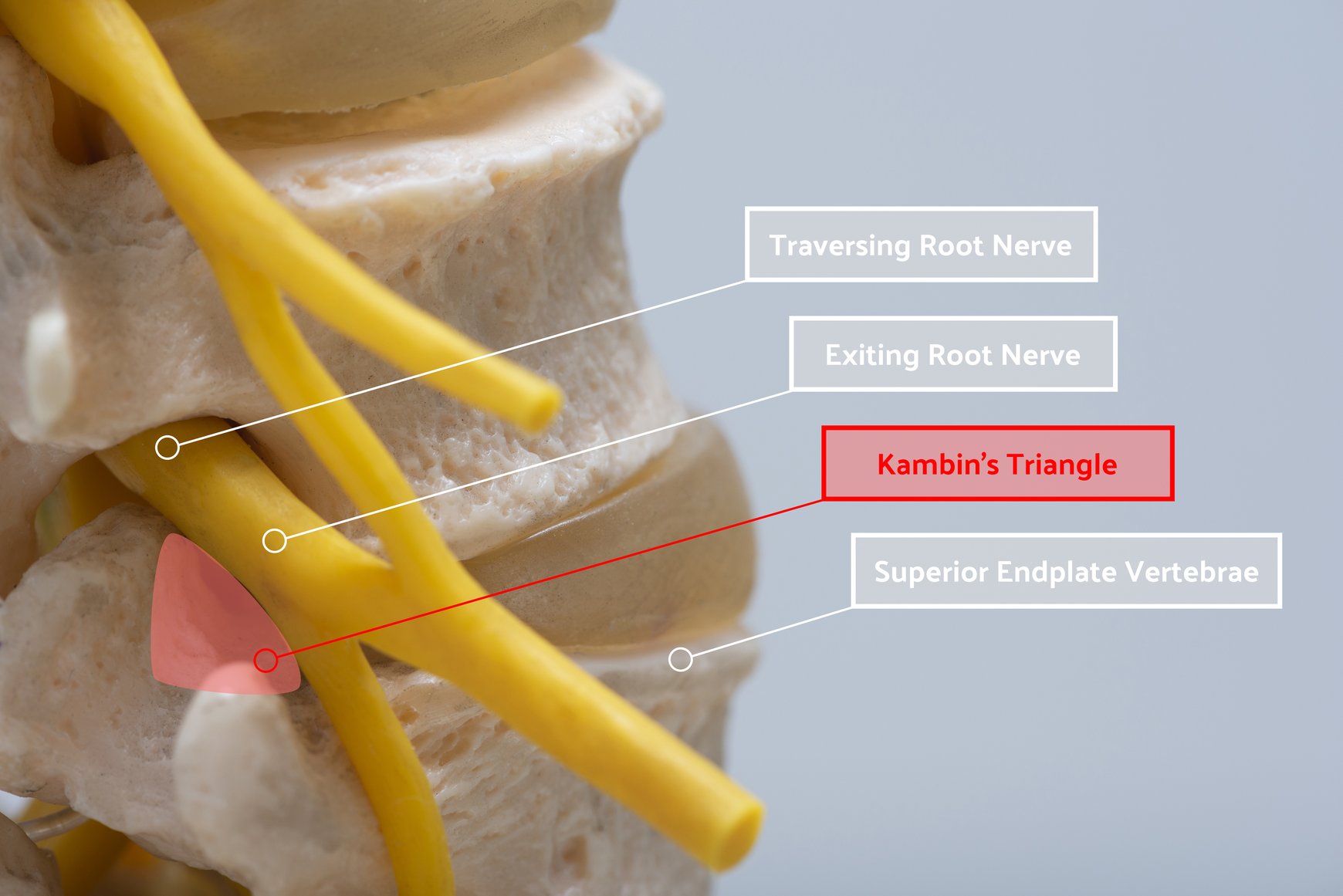 Oblique Lateral Interbody Fusion (OLIF) Surgery: Approach and Critical ...