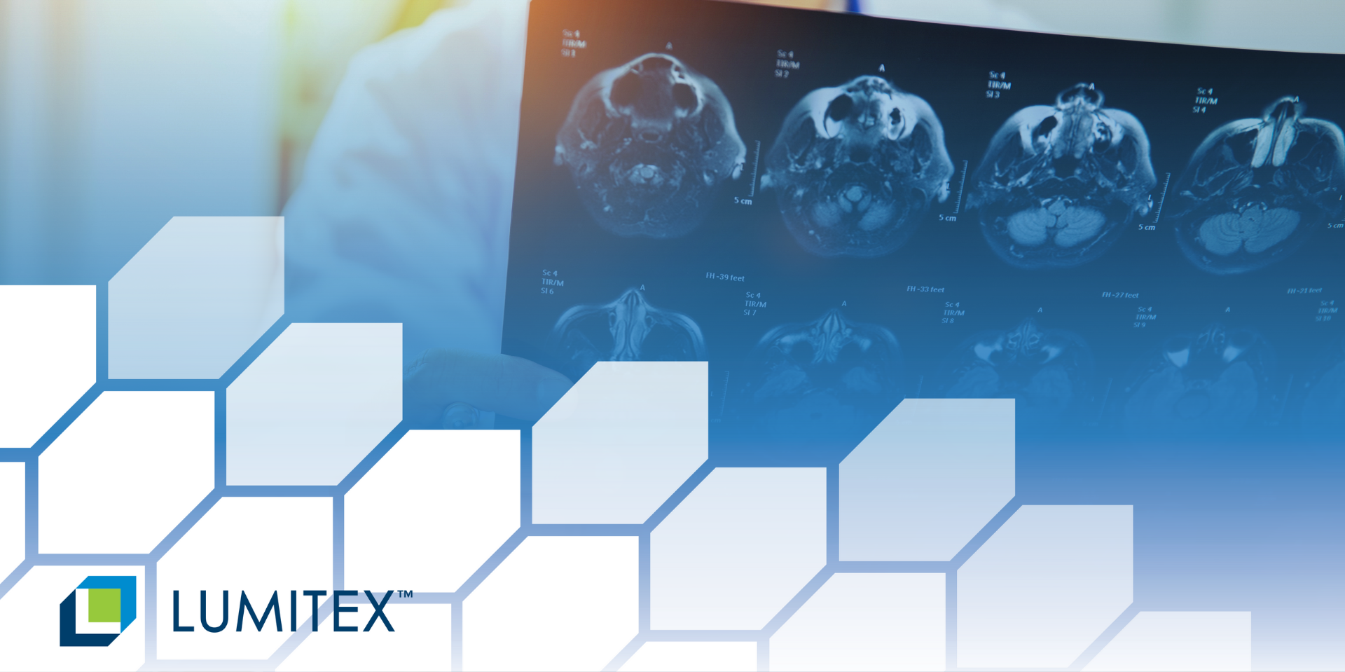 Innovative, Non-Invasive PBM Therapy for Neurological Healing